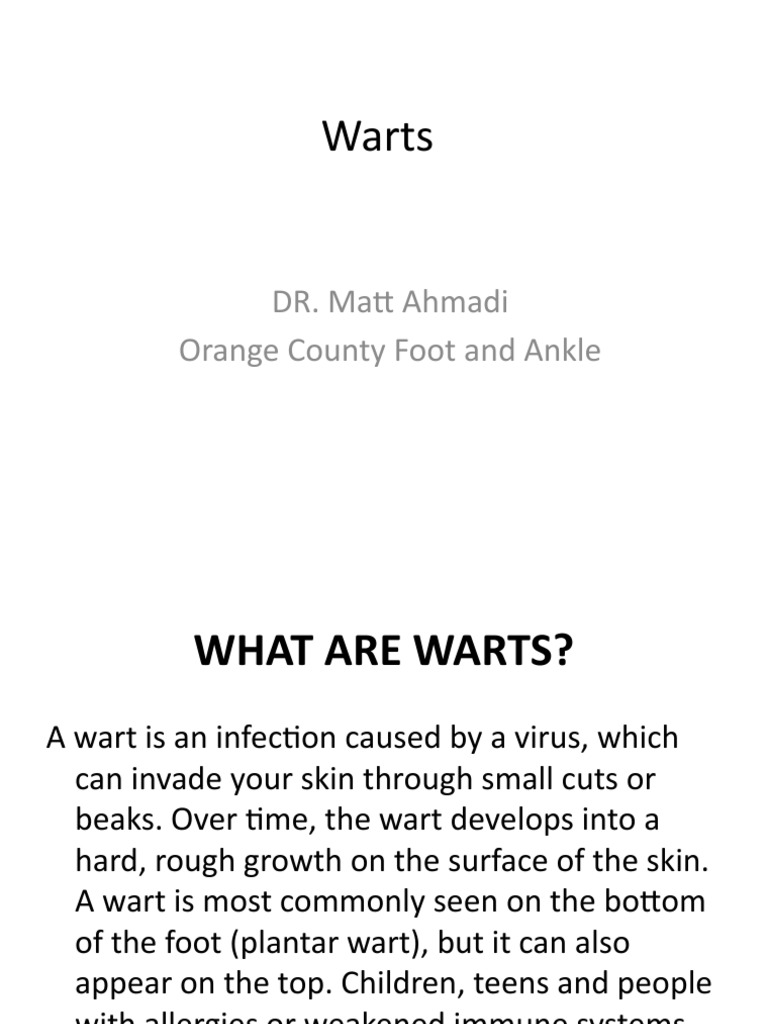 Warts: DR. Matt Ahmadi Orange County Foot and Ankle | PDF