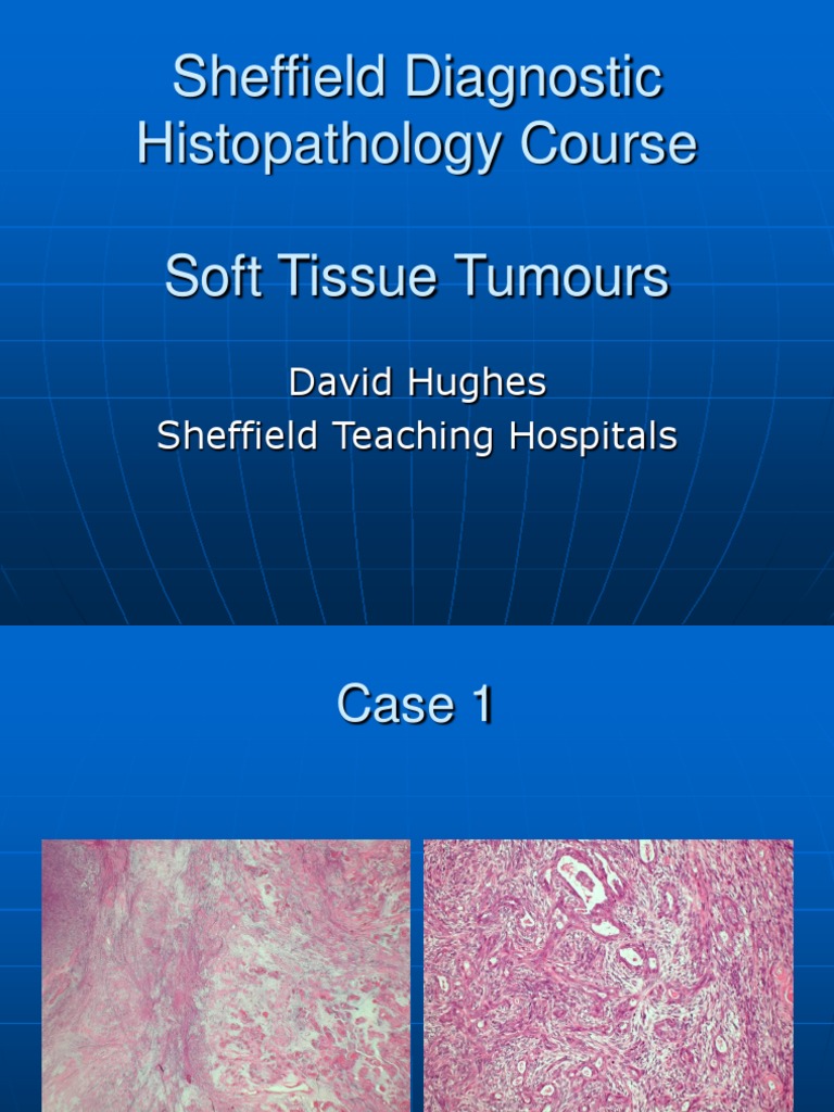 Soft Tissue | PDF | Neoplasms | Sarcoma