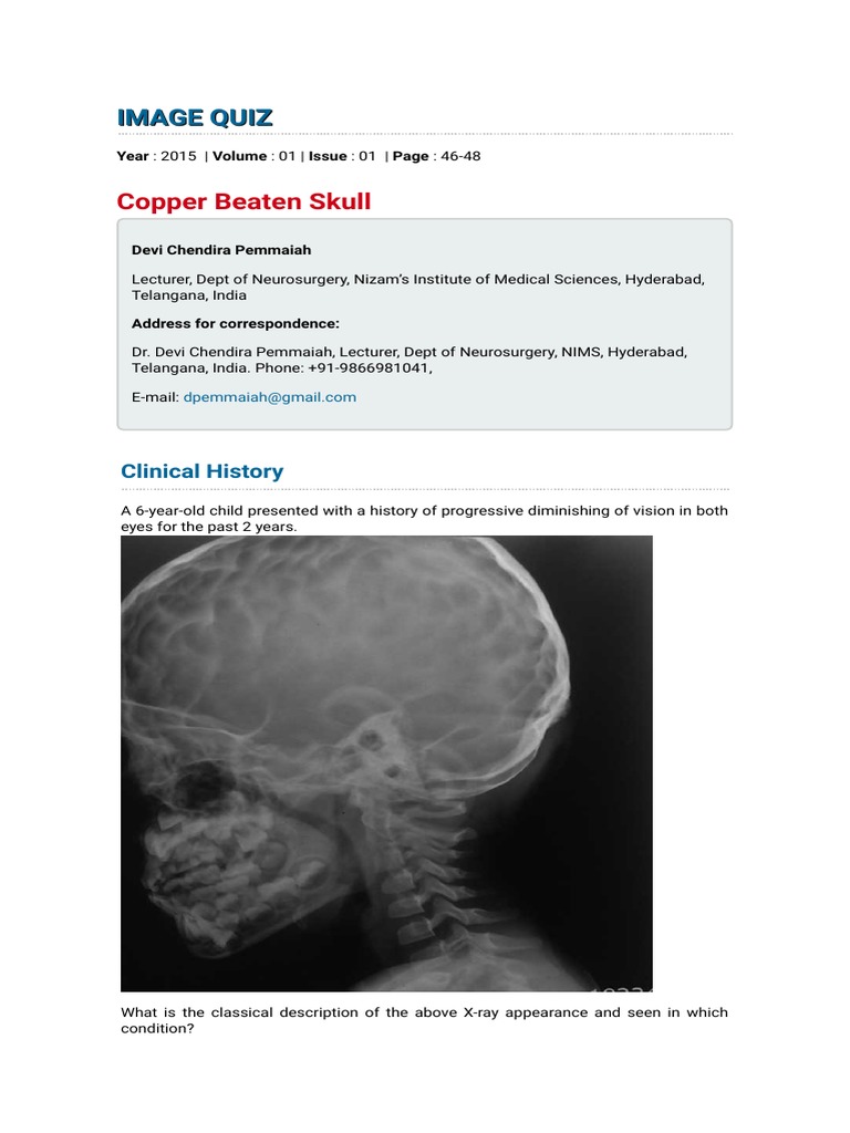 Copper Beaten Skull in Pediatrics | PDF | Medical Specialties ...