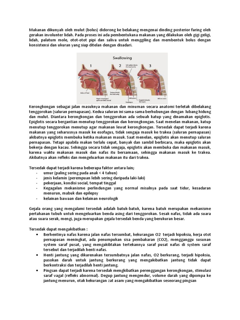 Mekanisme dan Penanganan Tersedak Makanan | PDF | Kesehatan Holistik