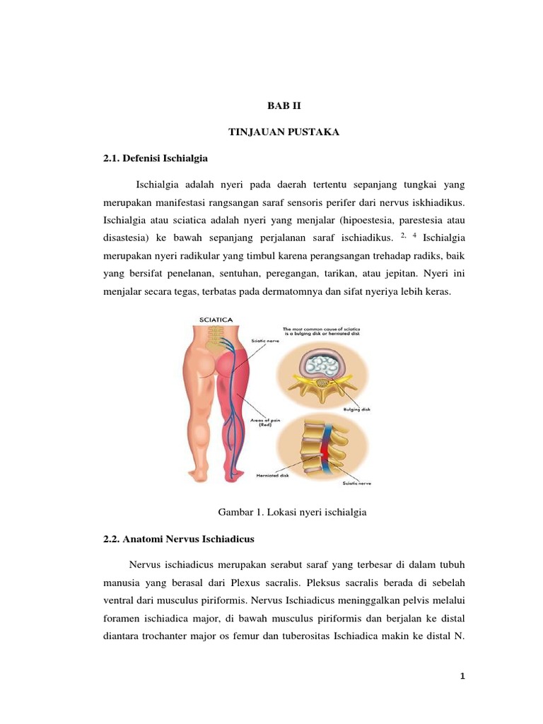 Ischialgia | PDF