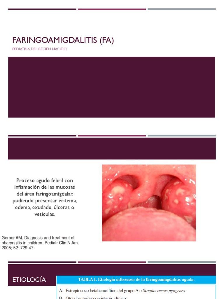 Faringoamigdalitis (FA) | PDF | Estreptococo | Resfriado comun