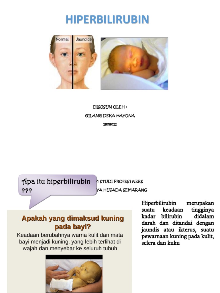 Lembar Balik Bilirubin | PDF