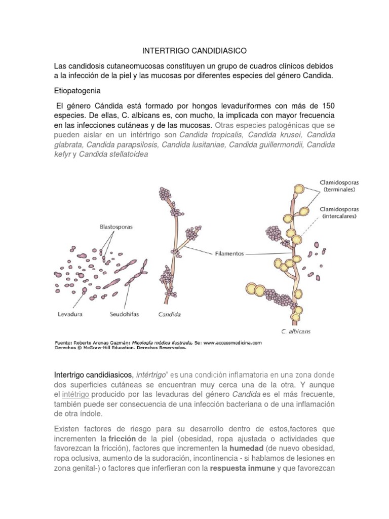 Intertrigo Candidiasico | PDF | Medicina | Inmunología