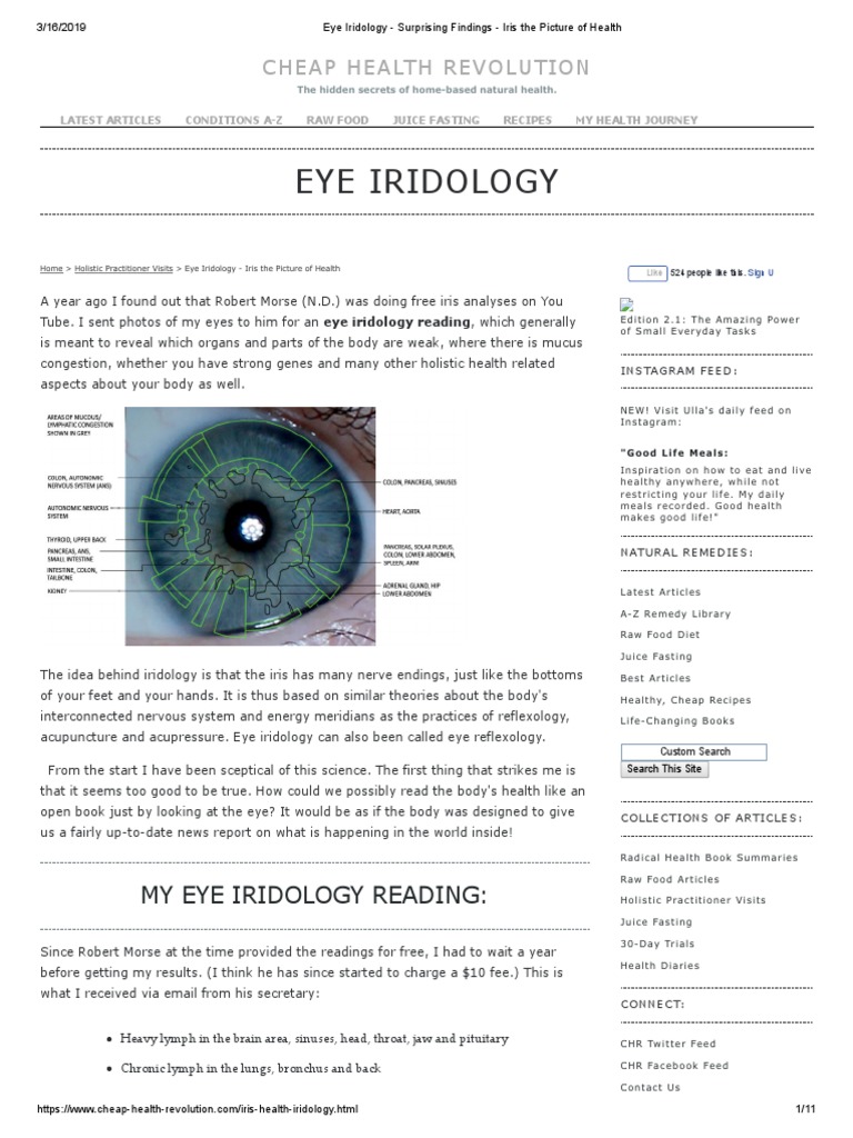 Eye Iridology - Surprising Findings - Iris The Picture of Health | PDF ...