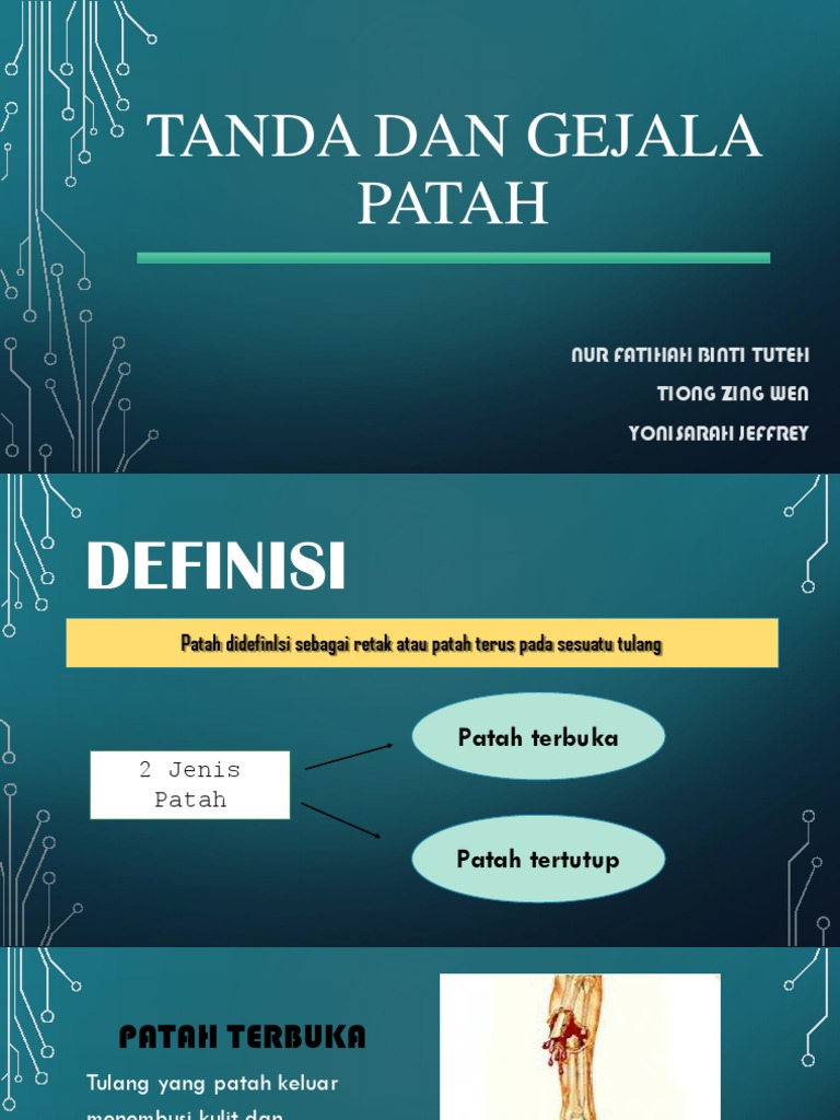 Tanda dan Gejala Patah Tulang | PDF