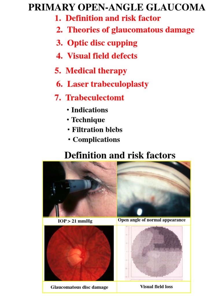 Theories of Glaucomatous Damage 1. Definition and Risk Factor | PDF ...