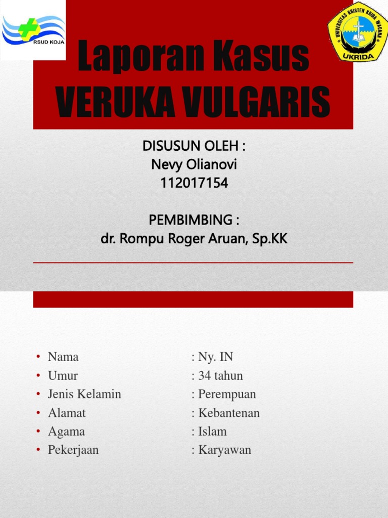 Laporan Kasus Veruka Vulgaris | PDF