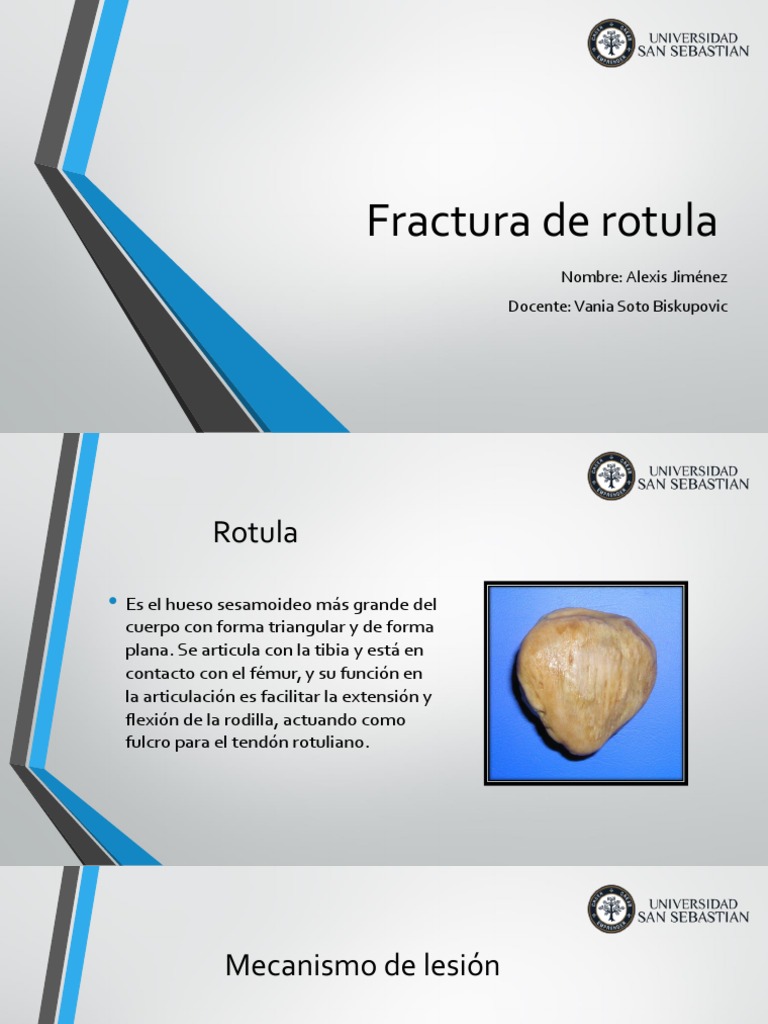 Fractura de Rotula | PDF | Rodilla | Sistema esquelético