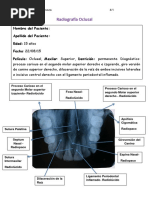 Canino Temporal Superior | PDF | Anatomia dental | Diente