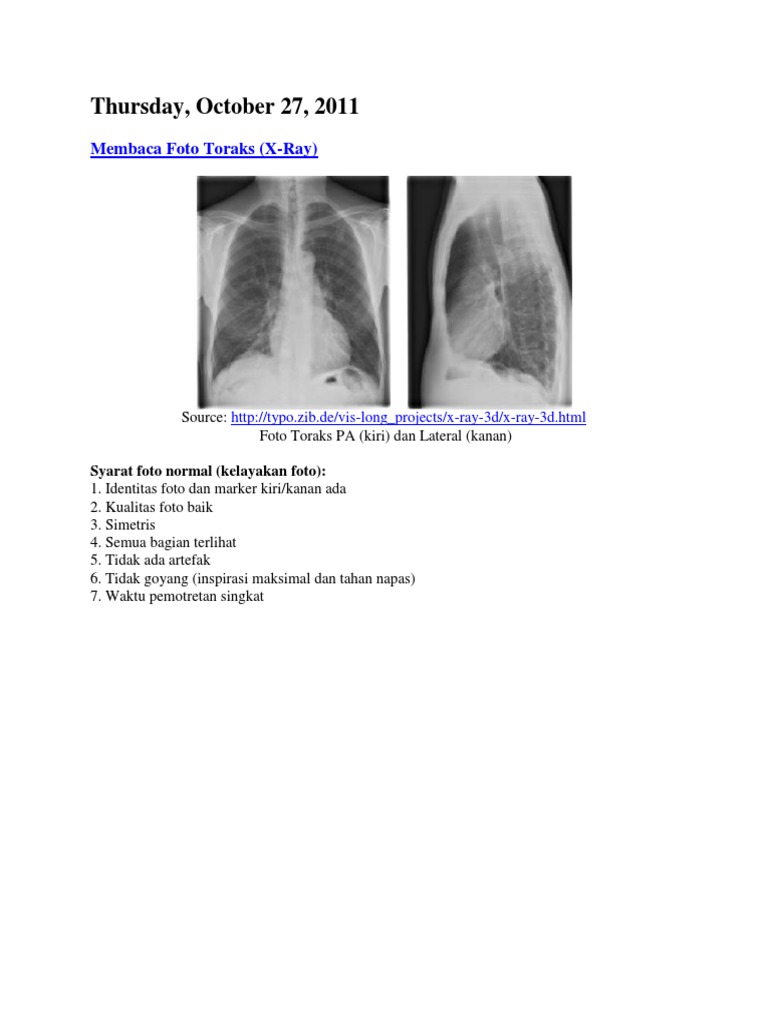 Cara Baca Rontgen | PDF