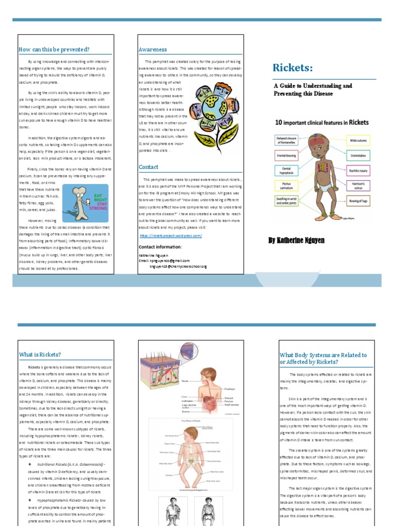 Rickets:: How Can This Be Prevented? Awareness | PDF | Vitamin D | Vitamin