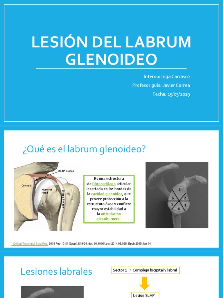 Lesión Del Labrum Glenoideo | PDF | Hombro | Ciencia de la danza