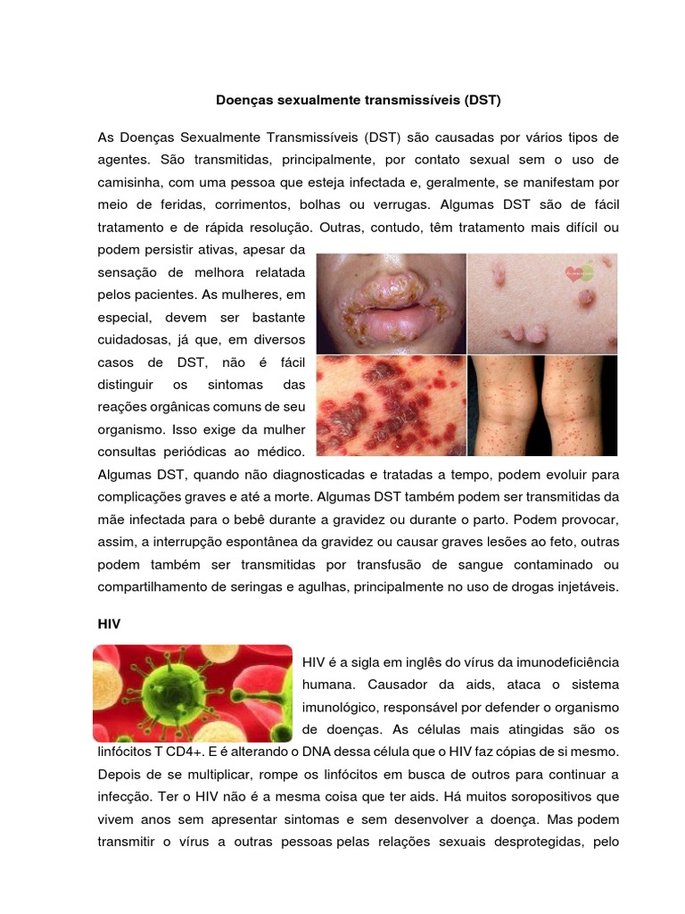 Doenças sexualmente transmissíveis | HIV/AIDS | Infecção Sexualmente ...