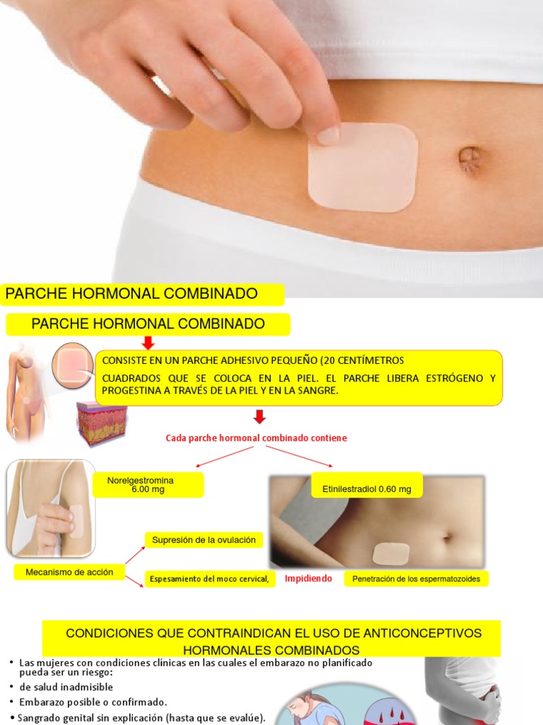Metodo Hormonal Combinado | PDF | El embarazo | Control de la natalidad
