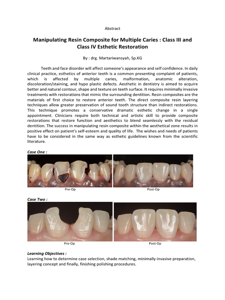 Abstract Manipulating Resin Composite For Multiple Caries | PDF | Art ...