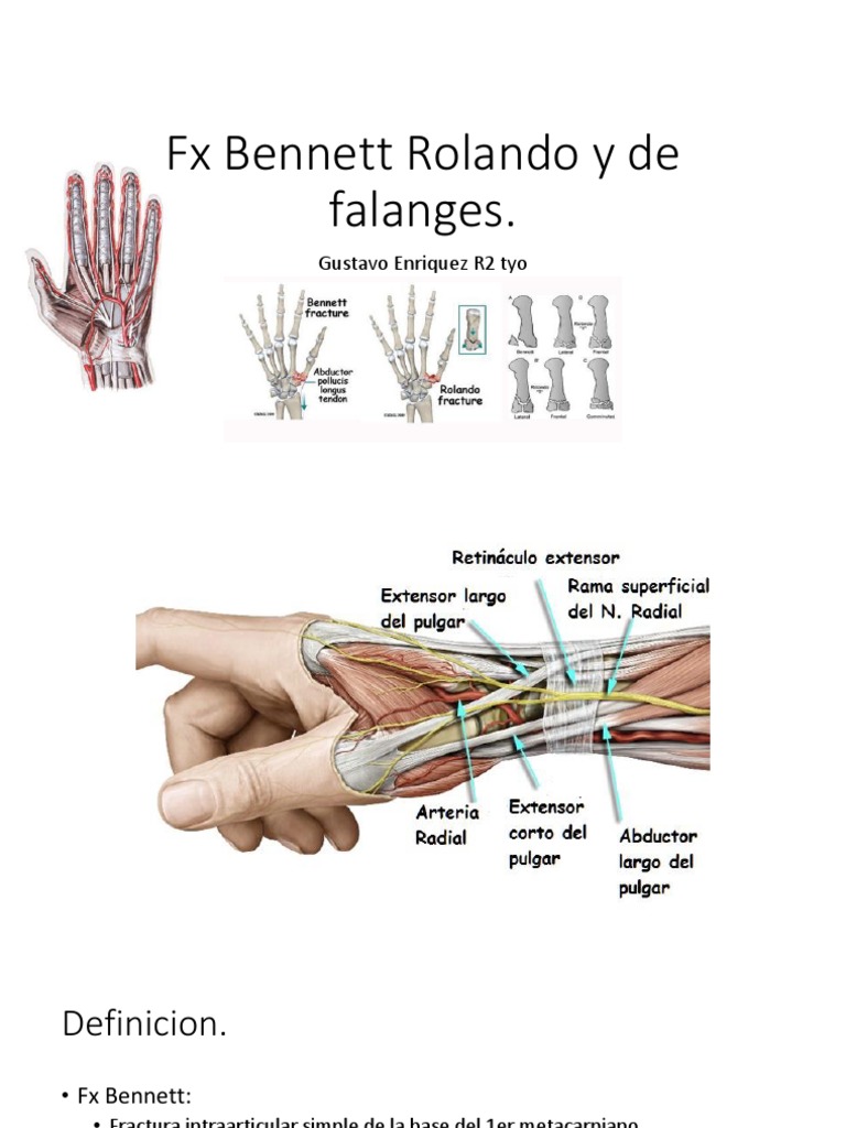 Bennett y Rolando Power | PDF | Mano | Extremidades (anatomía)