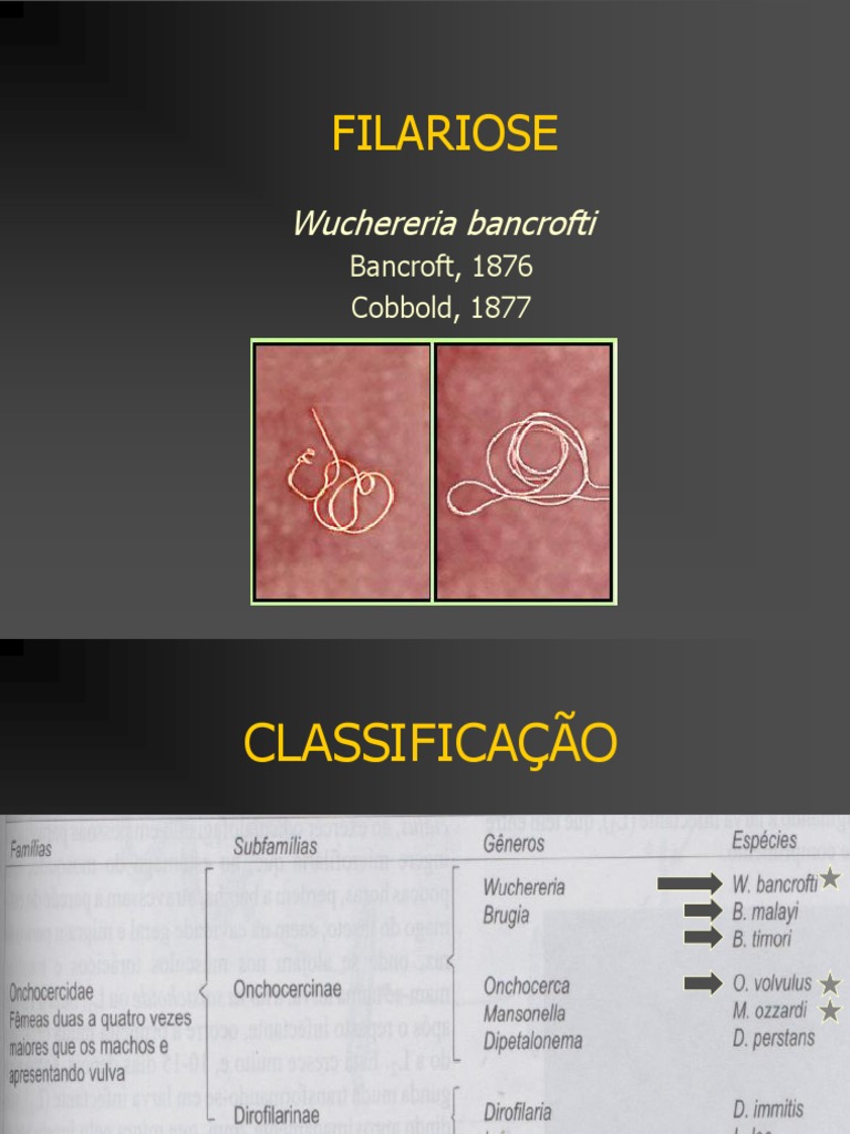 Filariose | PDF | Especialidades médicas | Medicina Clínica
