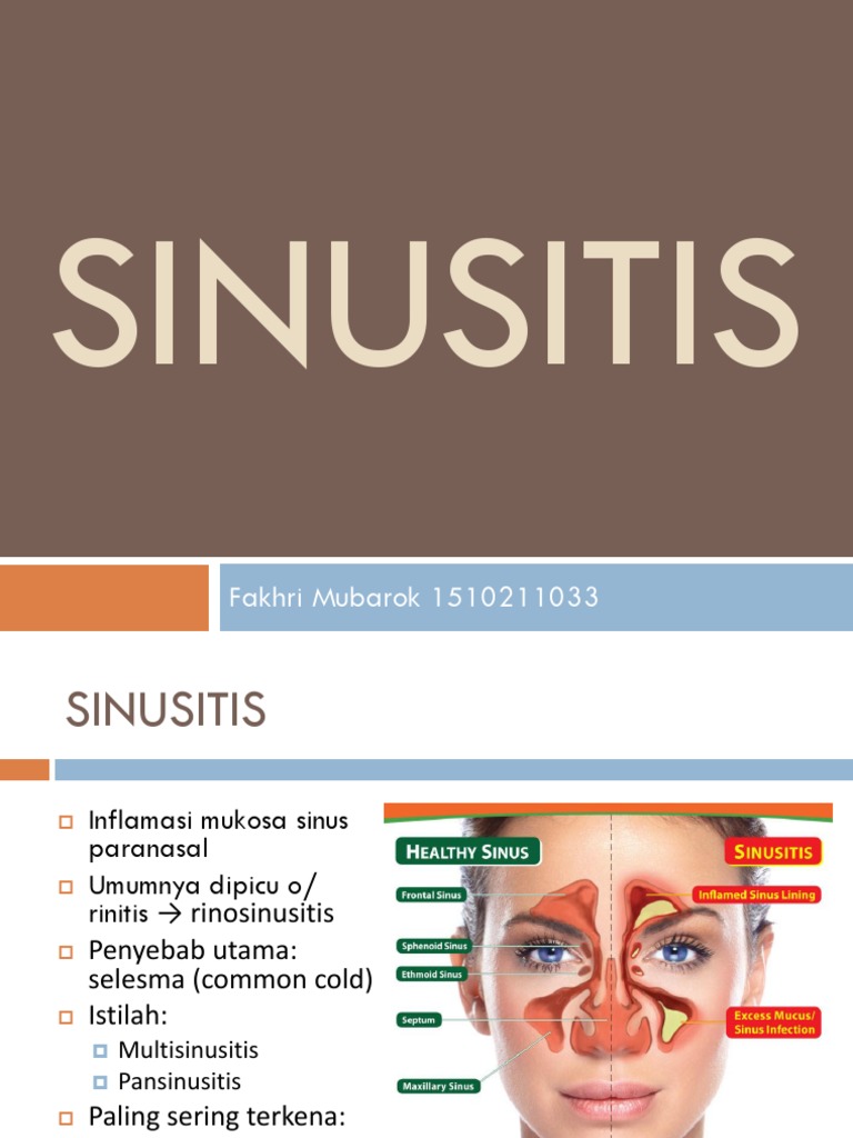 Sinusitis: Fakhri Mubarok 1510211033 | PDF | Respiratory System | Rhinology