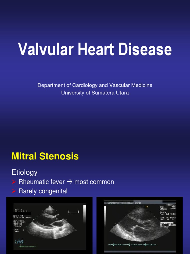 Valvular Heart Disease: Department of Cardiology and Vascular Medicine ...