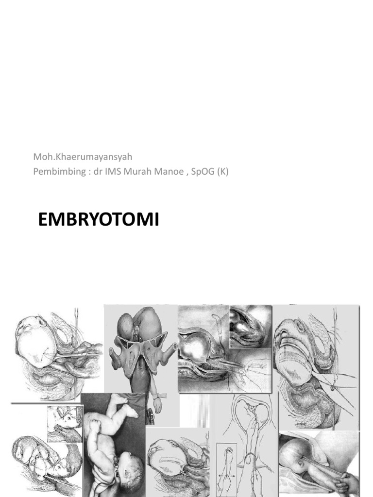 Embriotomy | PDF | Sains & Matematika