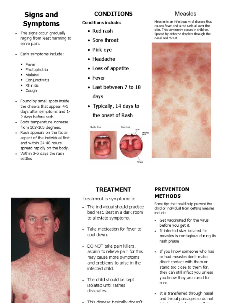 Measles Pamphlet | PDF | Measles | Infection