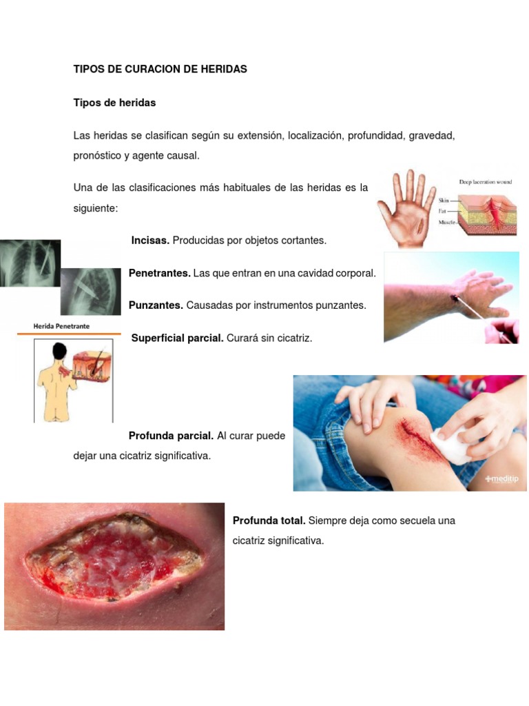 Tipos de Curacion de Heridas | PDF | Herida | Especialidades Medicas