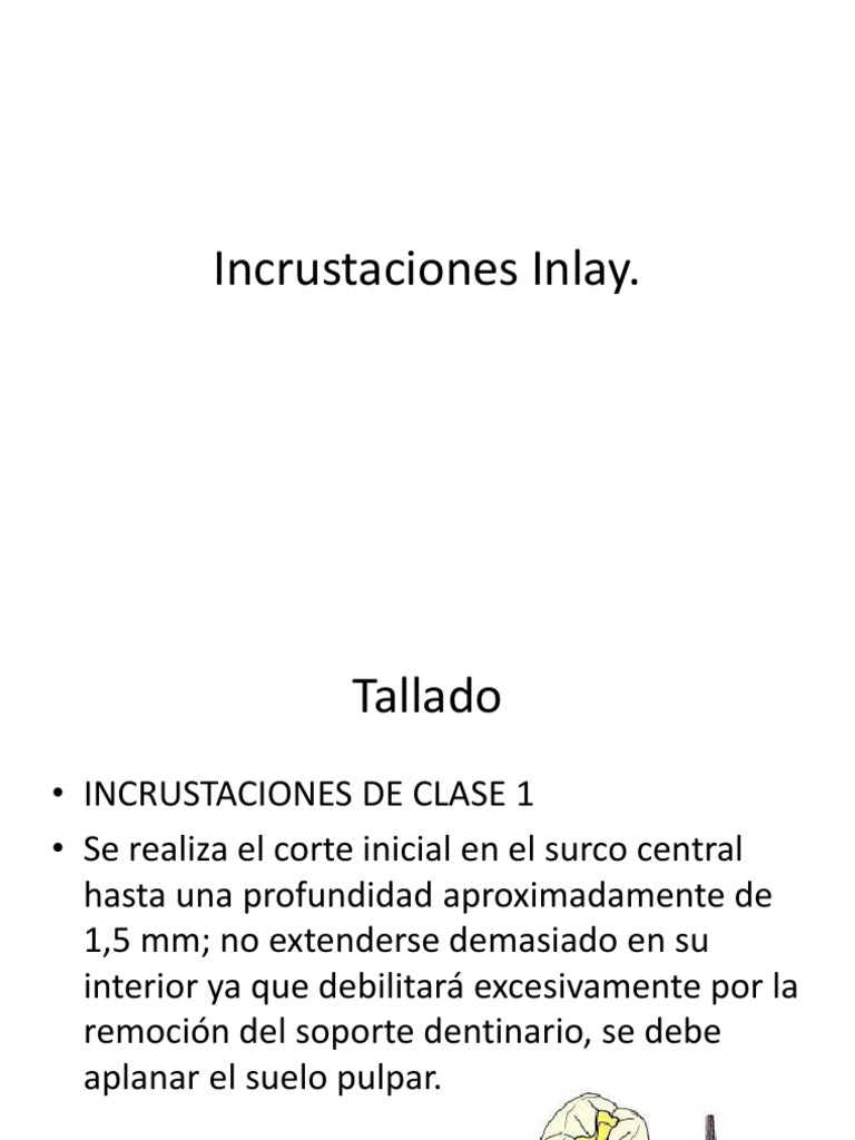 Incrustaciones Inlay | PDF | Naturaleza