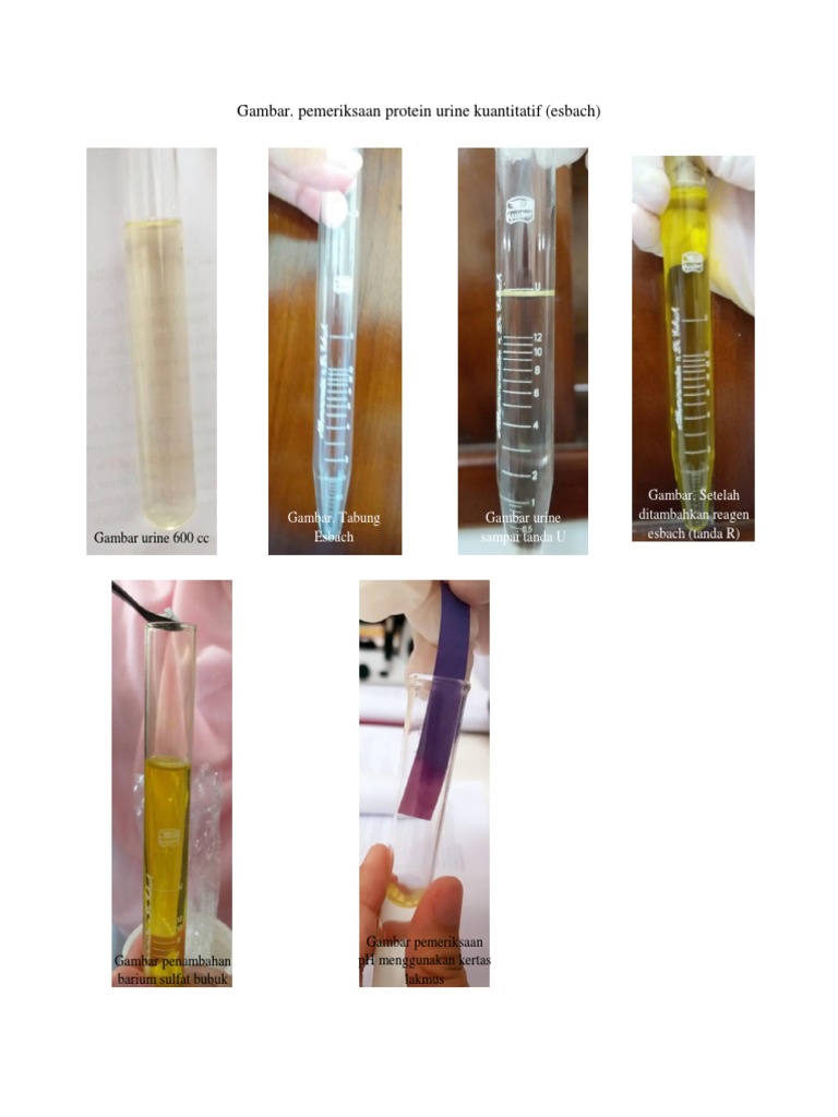 Hasil Dan Pembahasan Protein (Esbach) | PDF