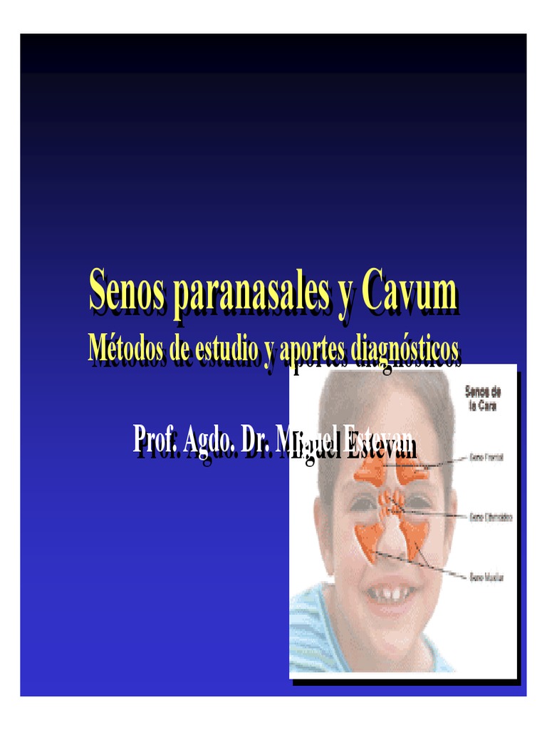 Diagnóstico y Anatomía del Cavum | PDF | Otorrinolaringología | Cabeza ...