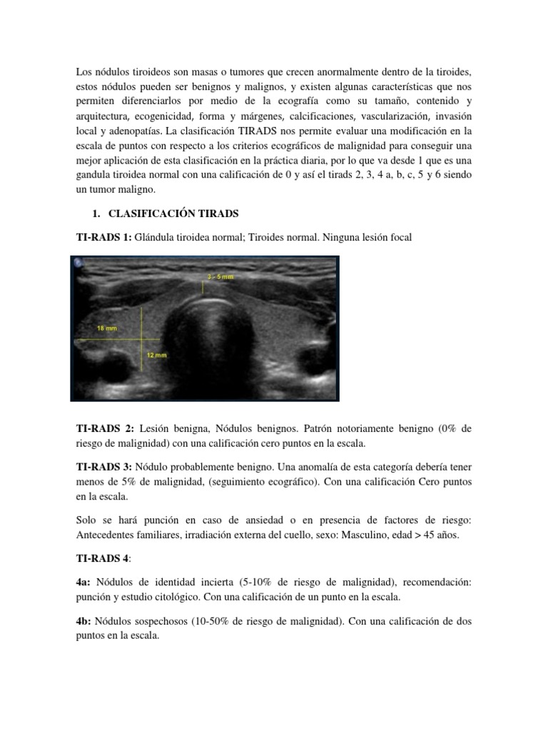 Clasificación TIRADS y nódulos tiroideos | PDF | Tiroides | Neoplasias