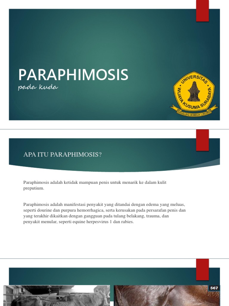 Paraphimosis | PDF