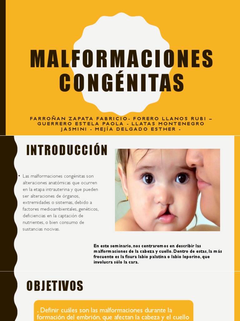 Malformaciones congénitas a