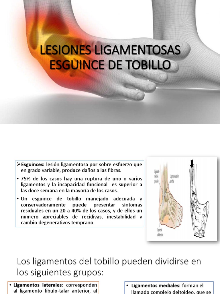 Lesiones Ligamentosas | PDF | Tobillo | Especialidades Medicas