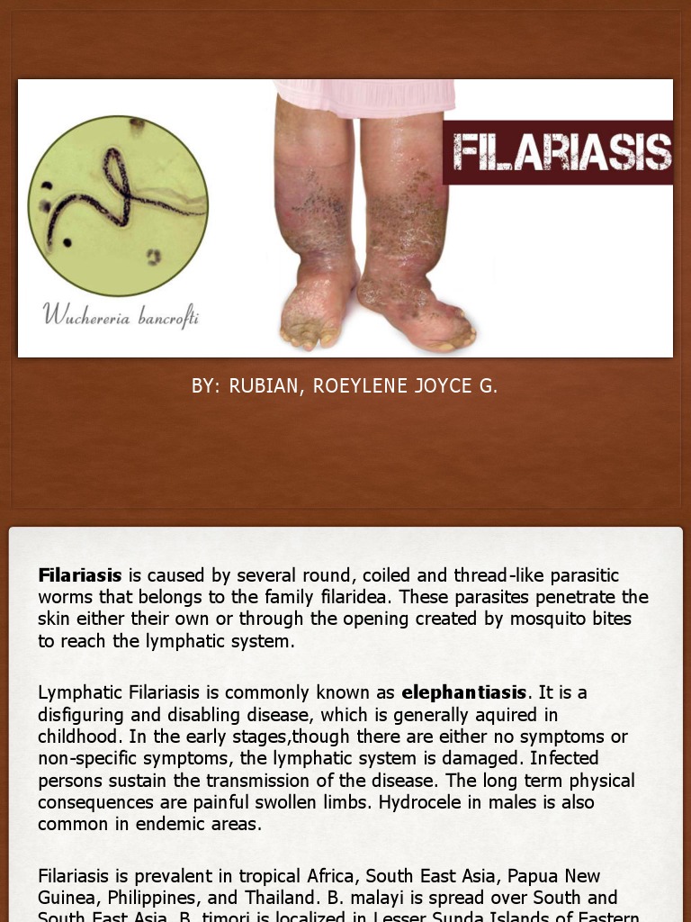 Filariasis | PDF | Medical Specialties | Diseases And Disorders
