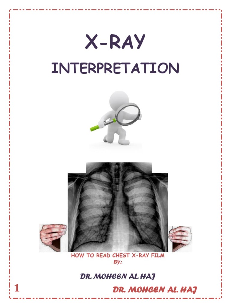 X-Ray Interpretation PDF | PDF | Lung | Thorax