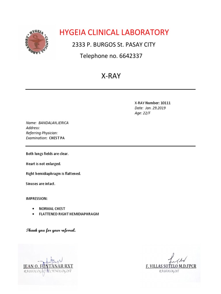 Chest X-Ray Report for 22-Year Old Female with Flattened Right ...