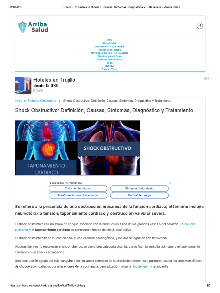 Shock Obstructivo | PDF | Choque (circulatorio) | Corazón