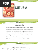 Incisión Trapezoidal - Sutura Continua Entrelazada | PDF | Cirugía ...