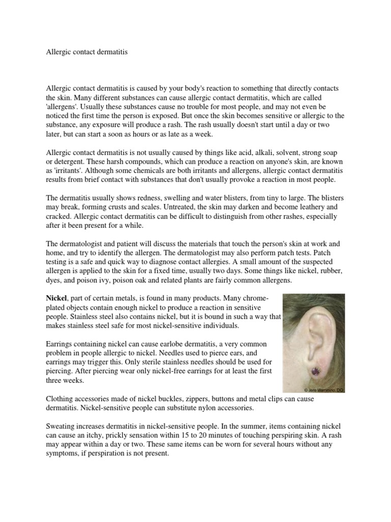 Allergic Contact Dermatitis AODC JOURNAL | Download Free PDF ...