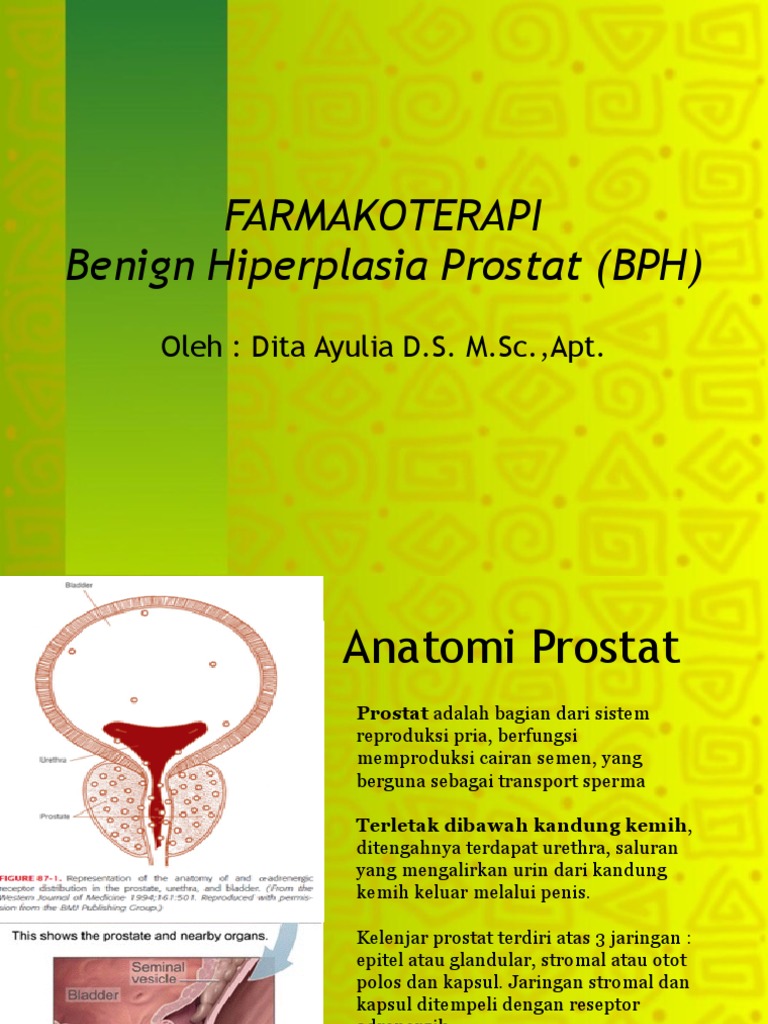 Benign Hiperplasia Prostat (BPH) PDF | PDF