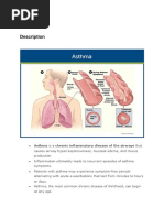 Case Study: Acute Bronchial Asthma | PDF | Asthma | Respiratory Tract
