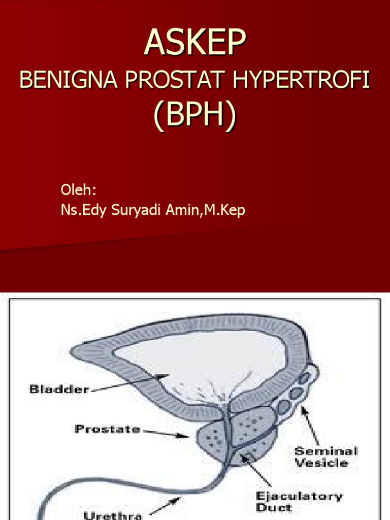 Askep BPH | PDF