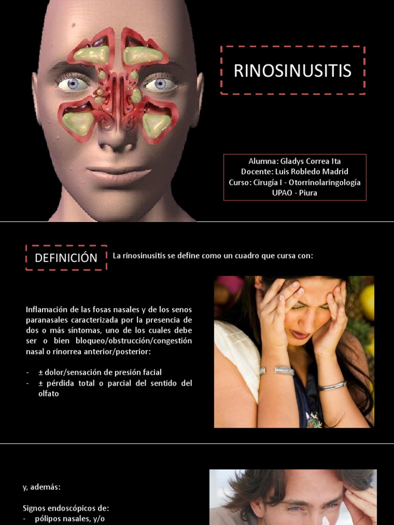 Rino Sinusitis | PDF | Especialidades Medicas | Medicina CLINICA
