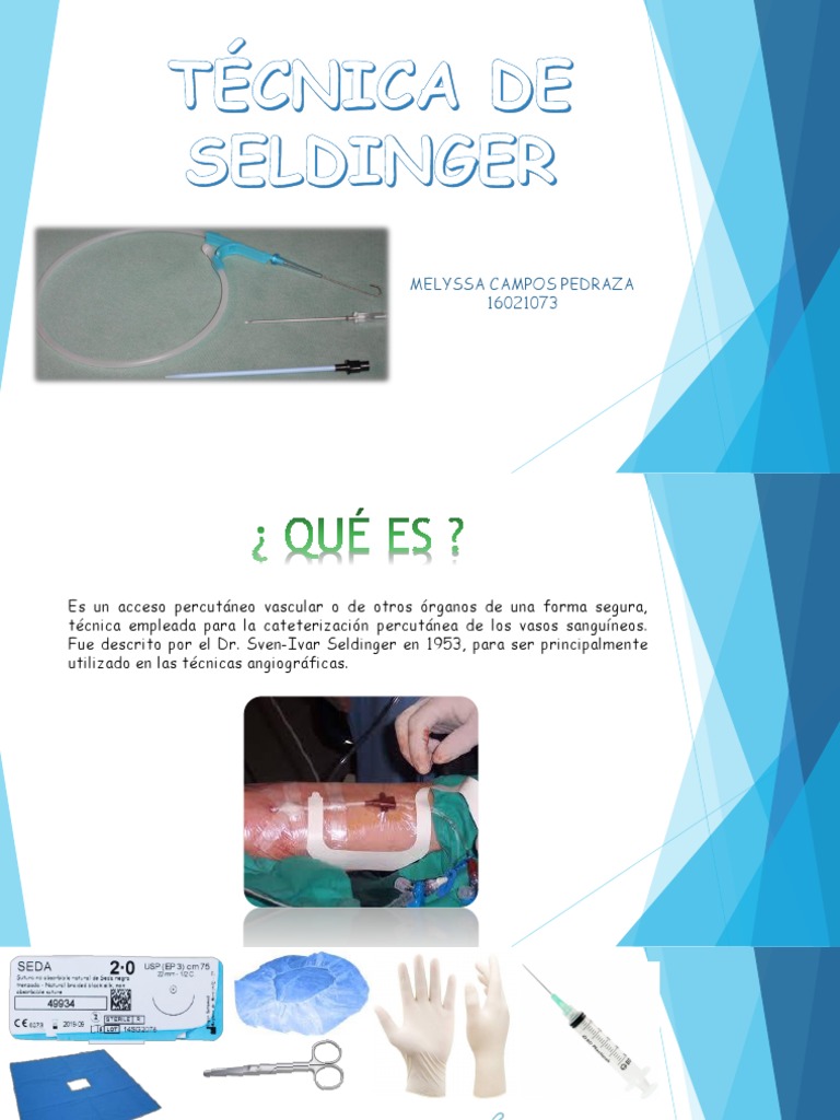 Técnica de Seldinger | PDF