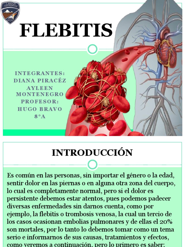 FLEBITIS | PDF | Sistema cardiovascular | Especialidades Medicas