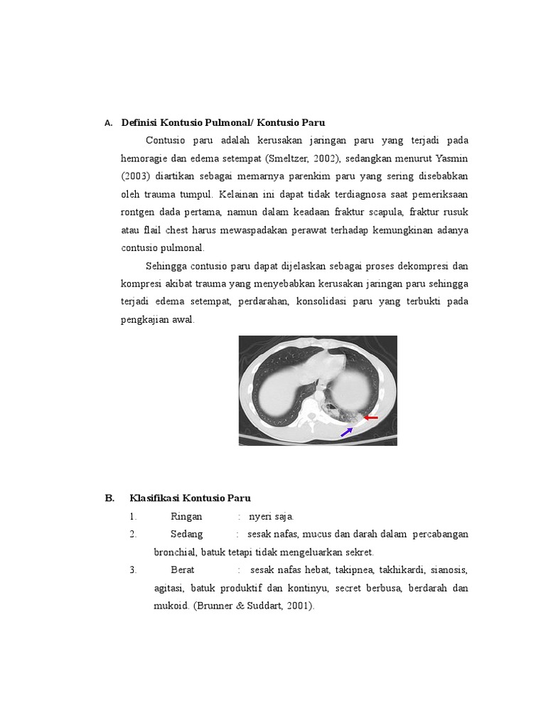 Kontusio Pulmonal | PDF | Sains & Matematika
