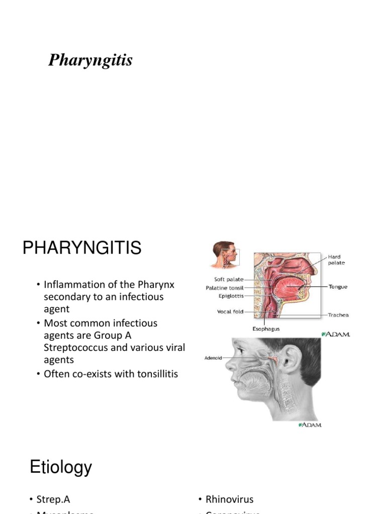 Pharyngitis | PDF | Otorhinolaryngology | Epidemiology