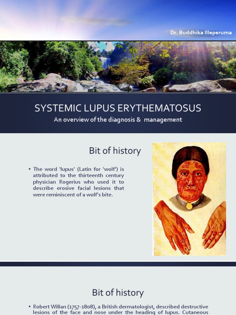 Sle Slides | PDF | Systemic Lupus Erythematosus | Cholesterol
