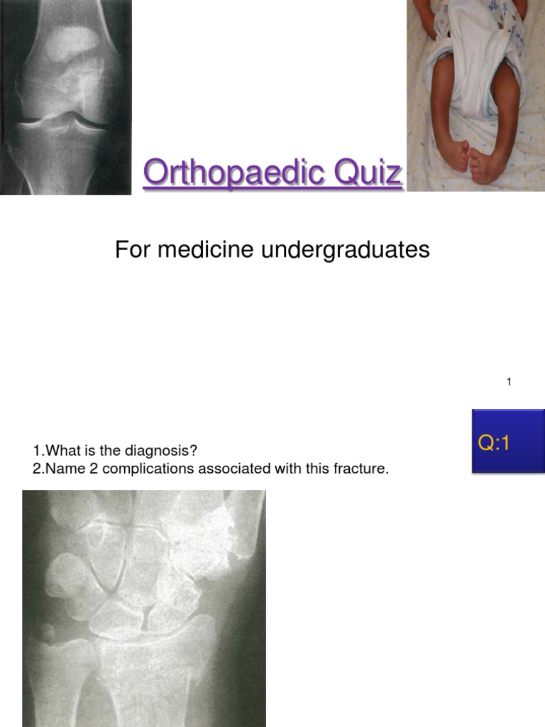 Orthopaedic Quiz: For Medicine Undergraduates | PDF | Musculoskeletal ...